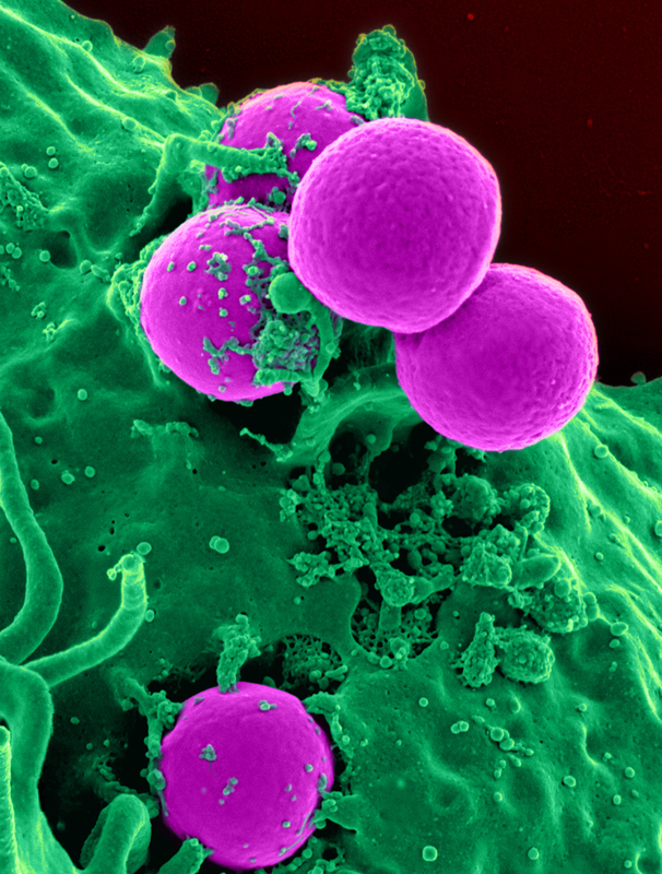 QI Storyboard: Reducing late onset MRSA & MSSA bacteraemias in newborn ...