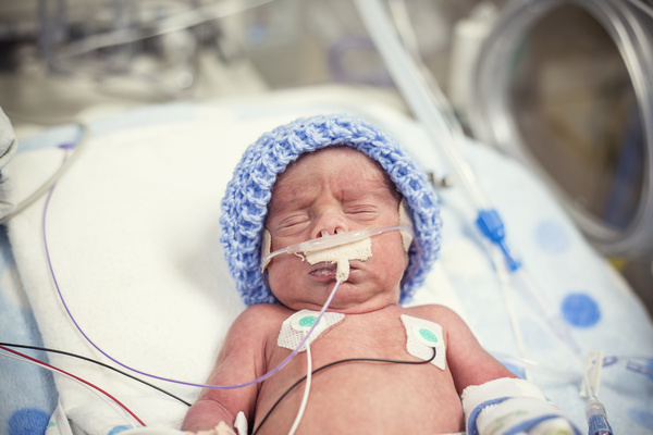 Perinatal Management of Extreme Preterm Birth Before 27 weeks of ... Perinatal Management of Extreme Preterm Birth Before 27 weeks of ...