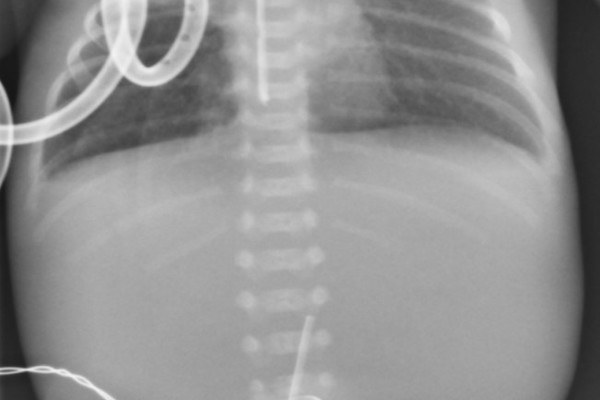 Resources | British Association of Perinatal Medicine