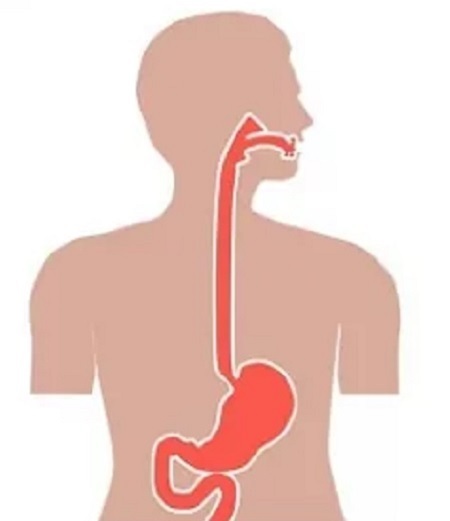 Gastro-Oesophageal Reflux Disorder (GORD) | Easy Health