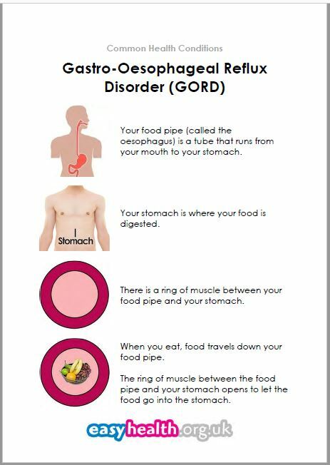Gastro-oesophageal Reflux Disease (GORD) | Easy Health