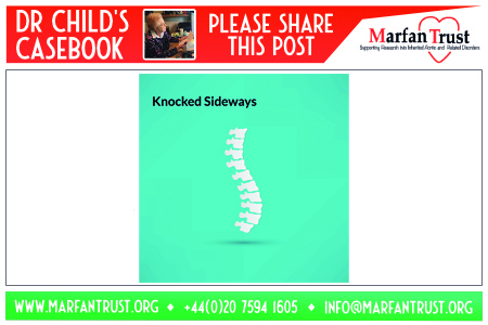 Dr Child's Casebook: – Knocked Sideways Part 1 | Marfan Trust