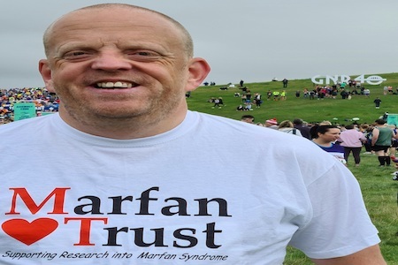 Fundraiser's Feat - Stuart's Story | Marfan Trust